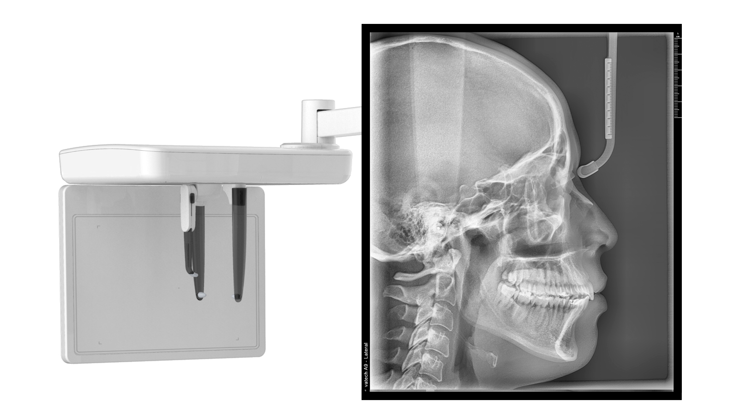 Panorâmico + Tomógrafo + Tele 3D Vatech A9 VATECH BRASIL - - Doctor Shop